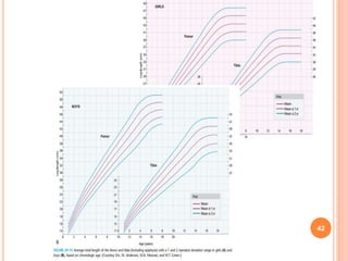 Limb length discrepancy | PPTX