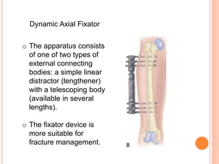 Limb length discrepancy | PPTX