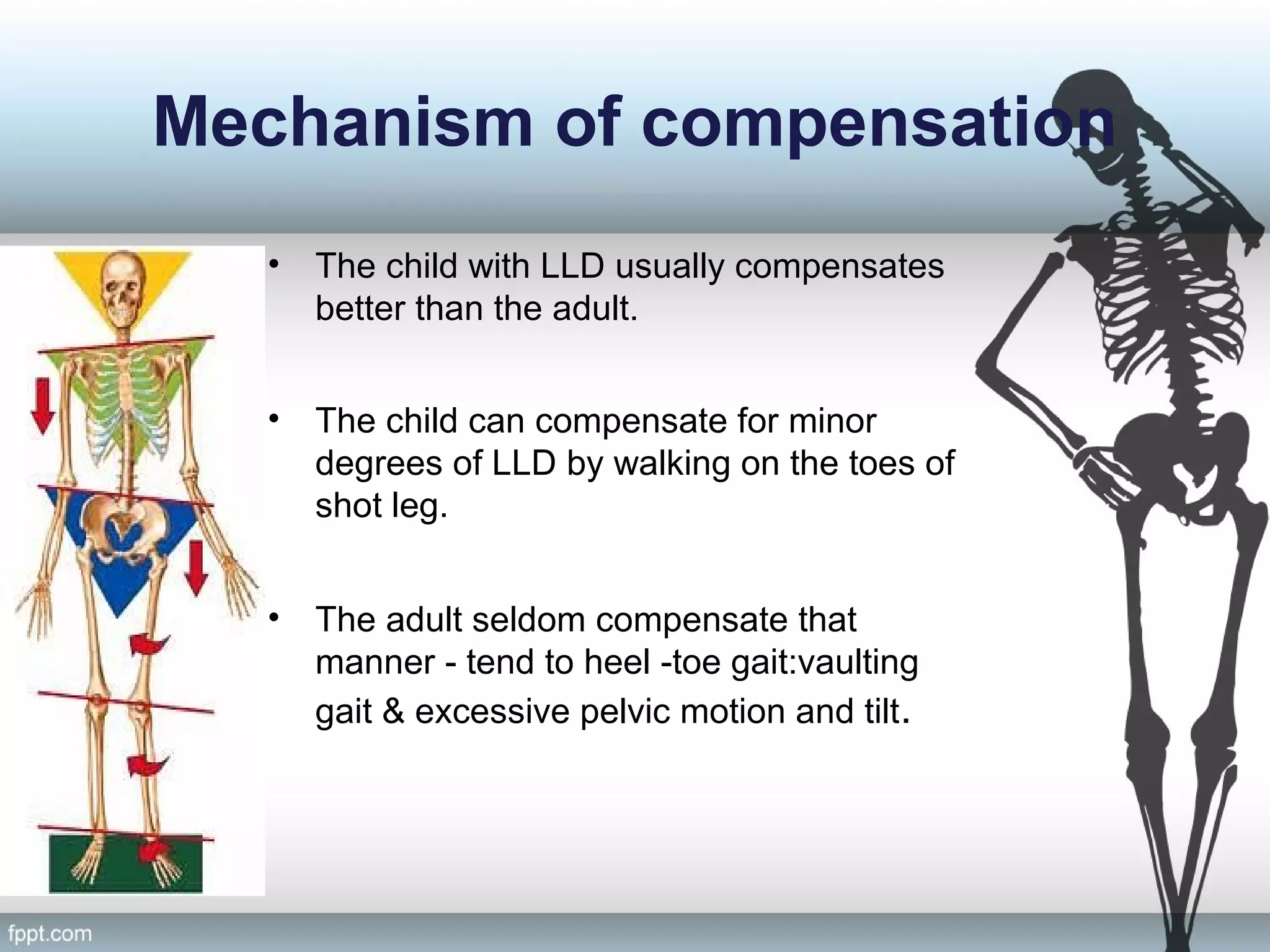 Limb length discrepency | PPT
