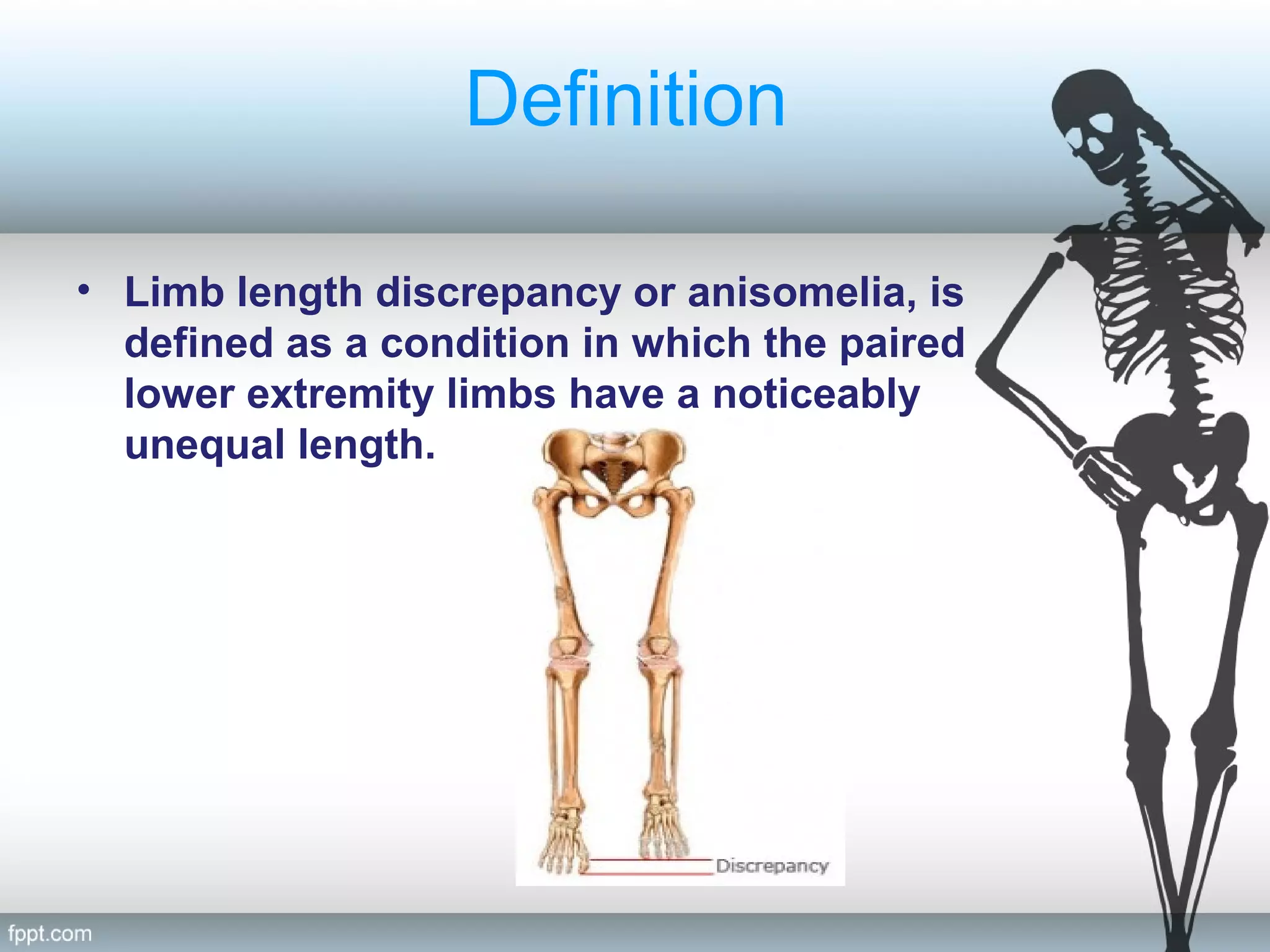 Limb length discrepency | PPT
