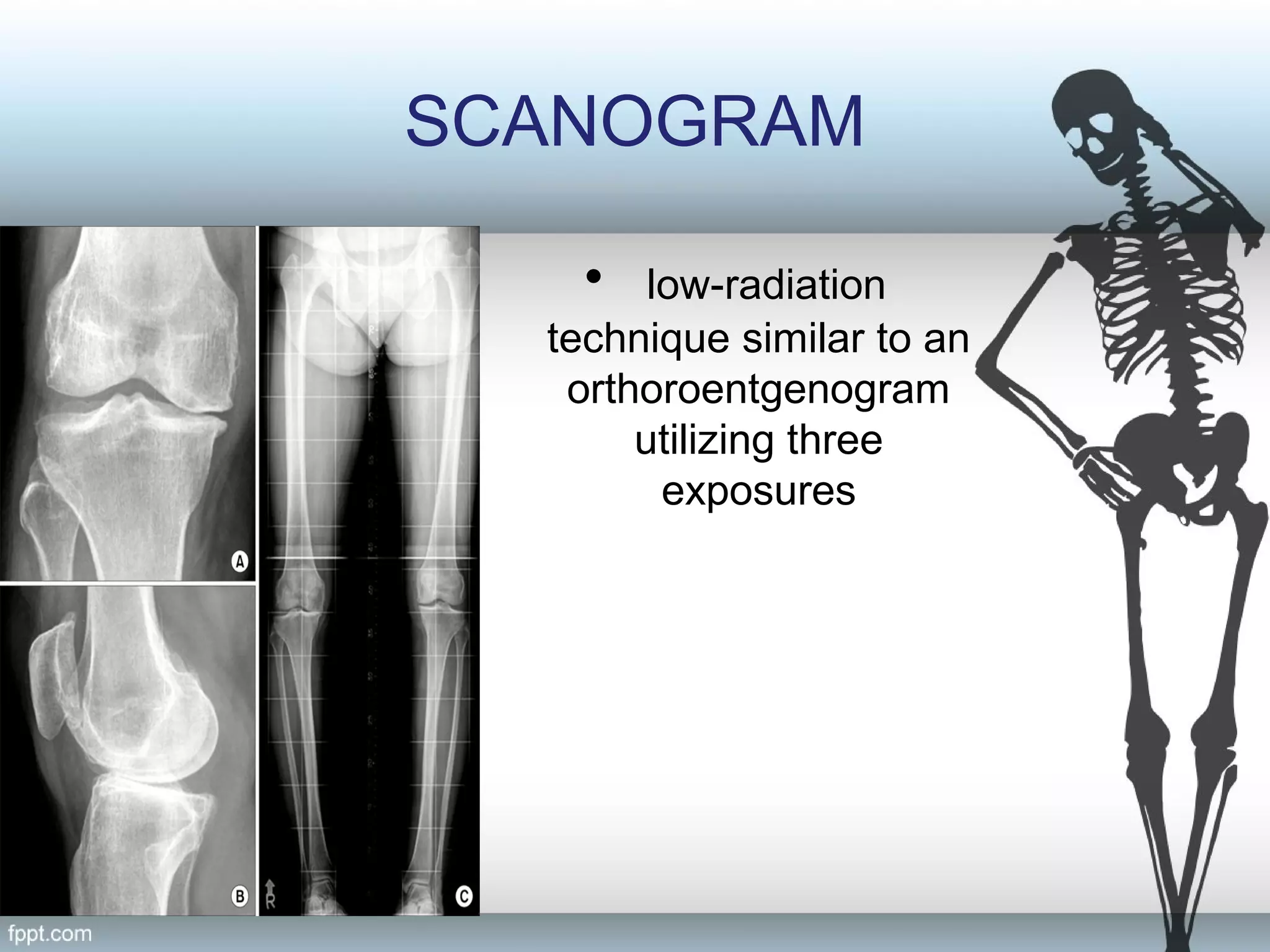 Limb length discrepency | PPT