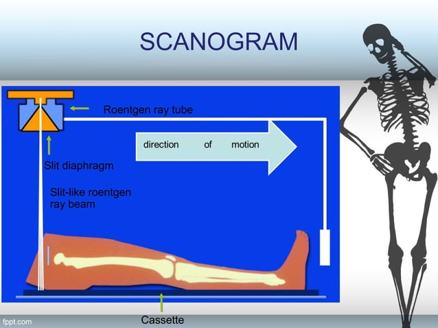 Limb length discrepency | PPT