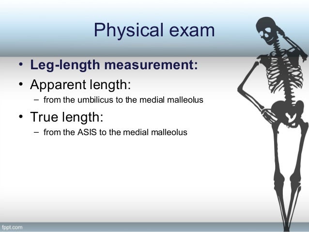 Limb length discrepency