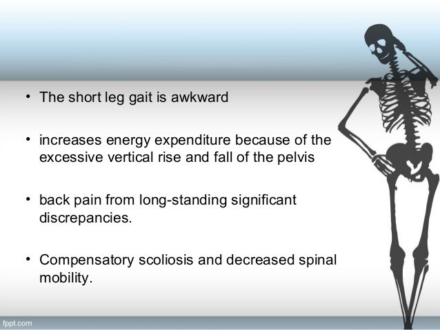 Limb length discrepency