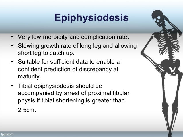 Limb length discrepency