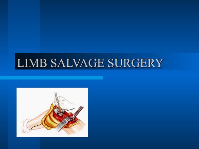 Limb salvage Surgery | PPT