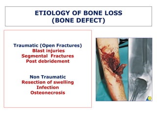Limb salvage in severe trauma | PPT