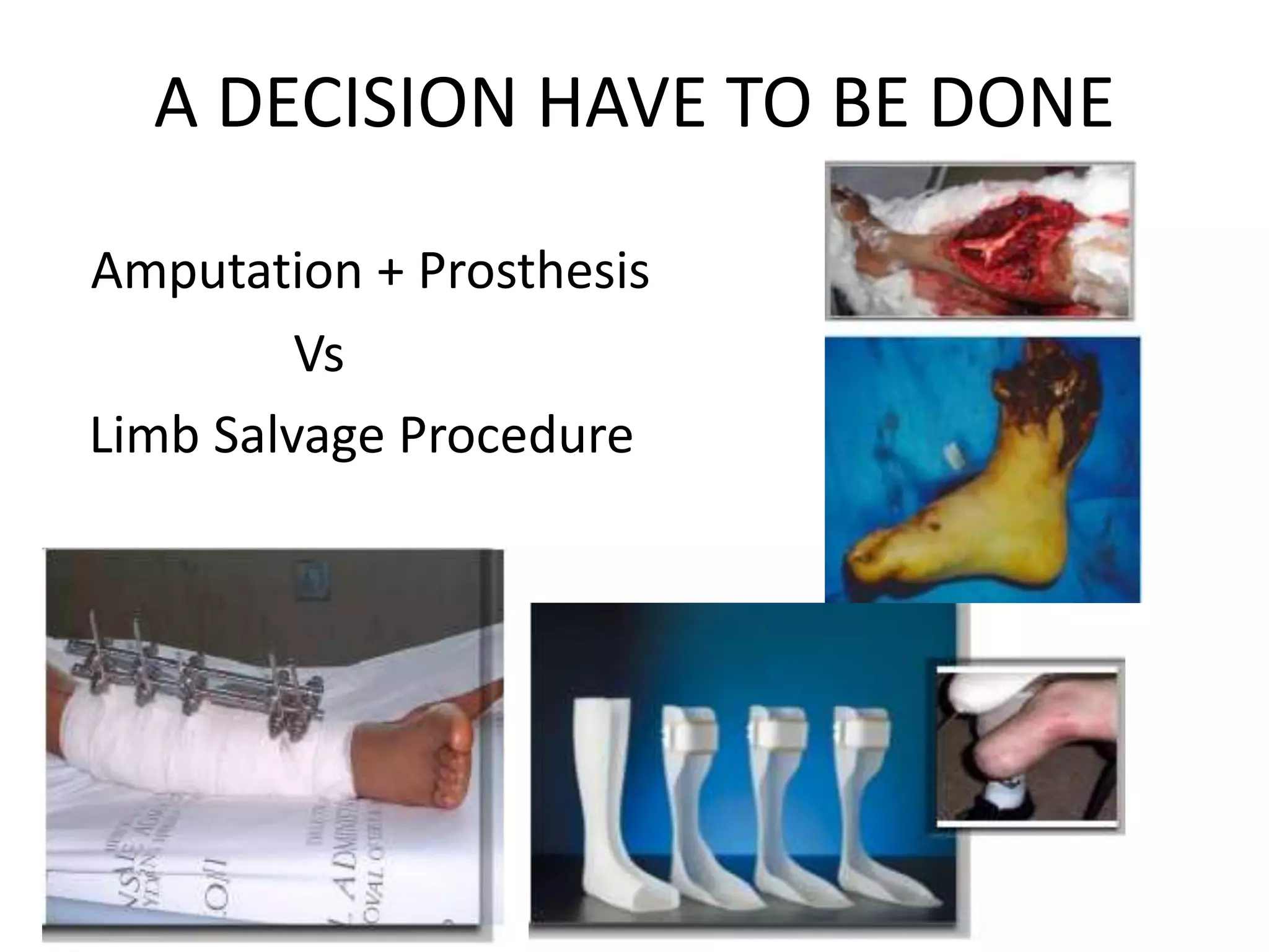 Limb salvage vs amputation final | PPTX