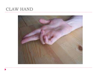 Limbs applied anatomy 2015 | PPTX