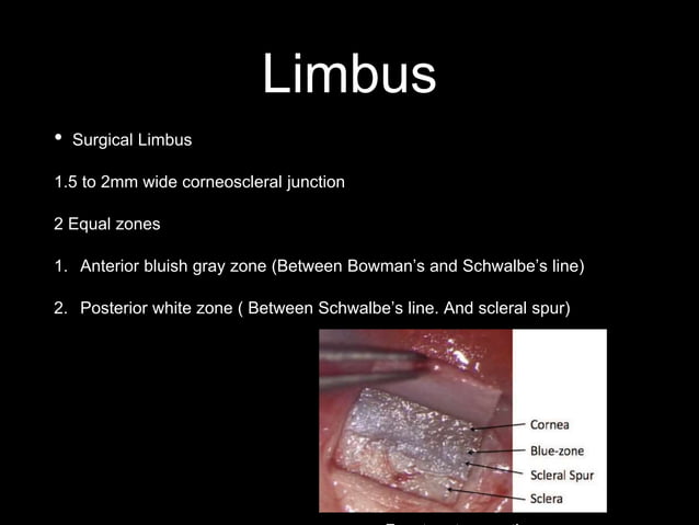 Limbus and Anterior Chamber Angle by Dr. ZAW MIN HTET | PPTX | Eye and ...