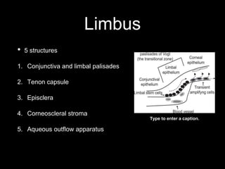 Limbus and Anterior Chamber Angle by Dr. ZAW MIN HTET | PPTX | Eye and ...