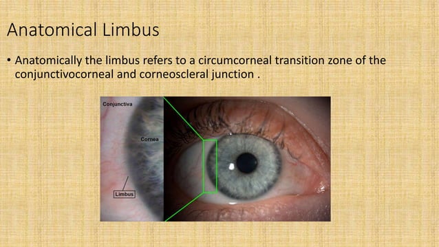 Limbus and Sclera.pptx