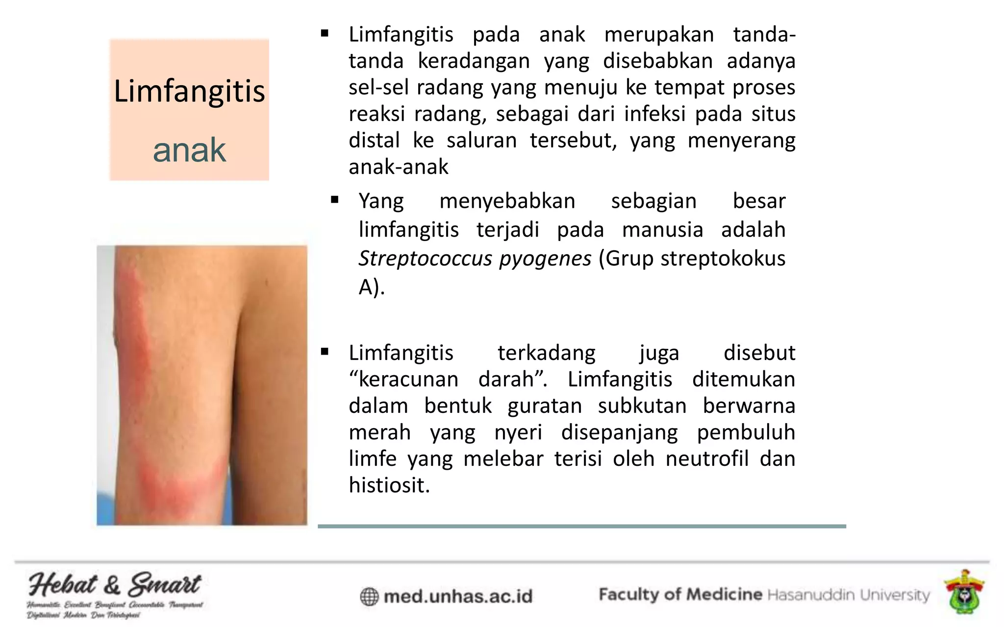 Limfangitis pada anak.pptx
