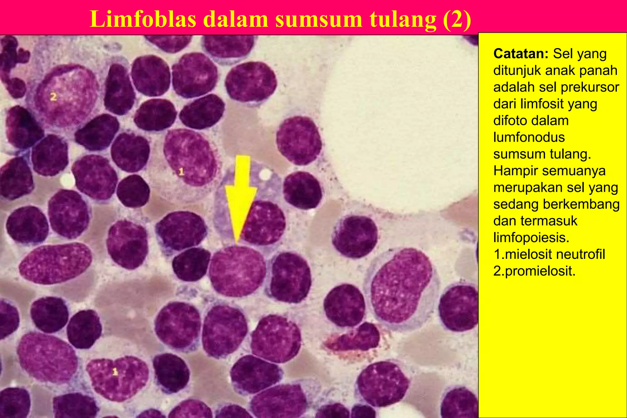 Limfopoiesis.ppt