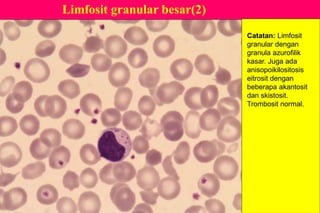 Limfopoiesis.ppt