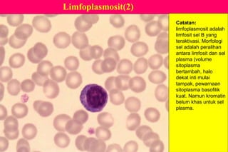 Limfopoiesis.ppt