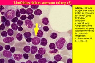 Limfopoiesis.ppt