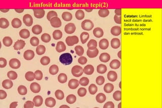 Limfopoiesis.ppt