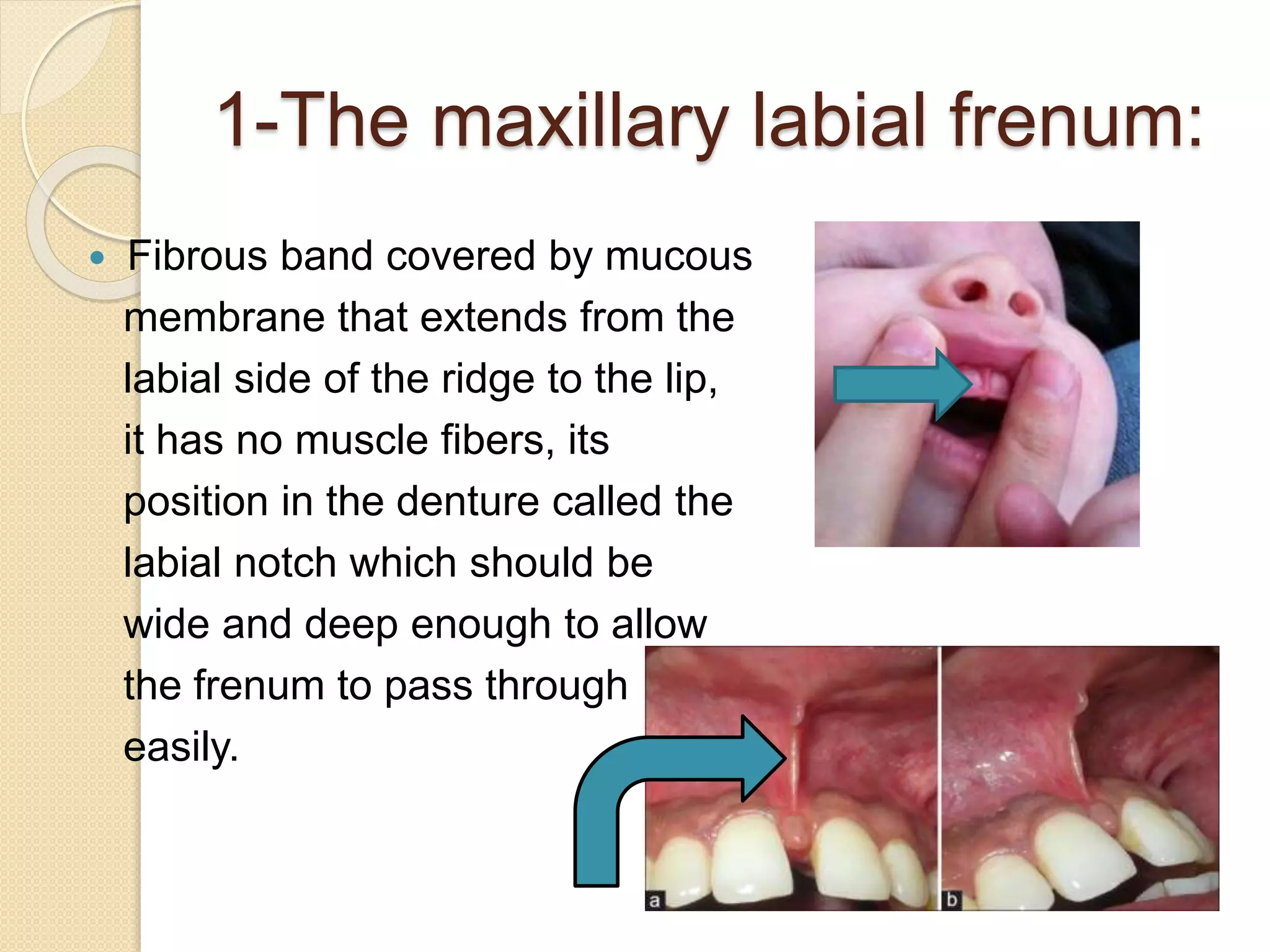 Limiting structure presentation | PPTX