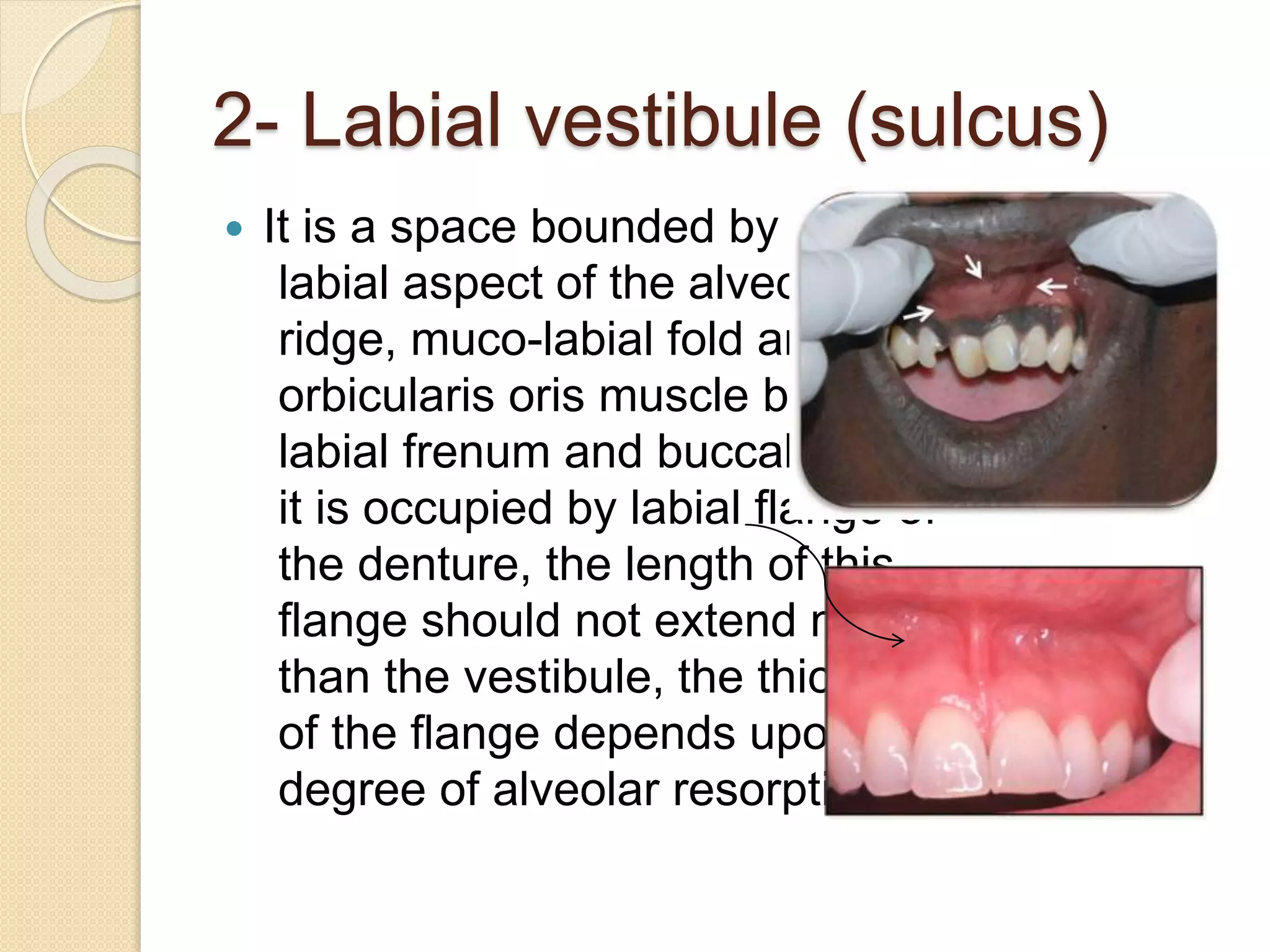 Limiting structure presentation | PPTX