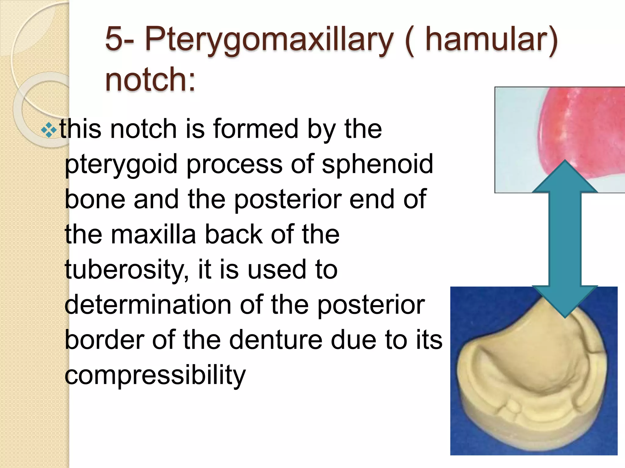 Limiting structure presentation | PPTX