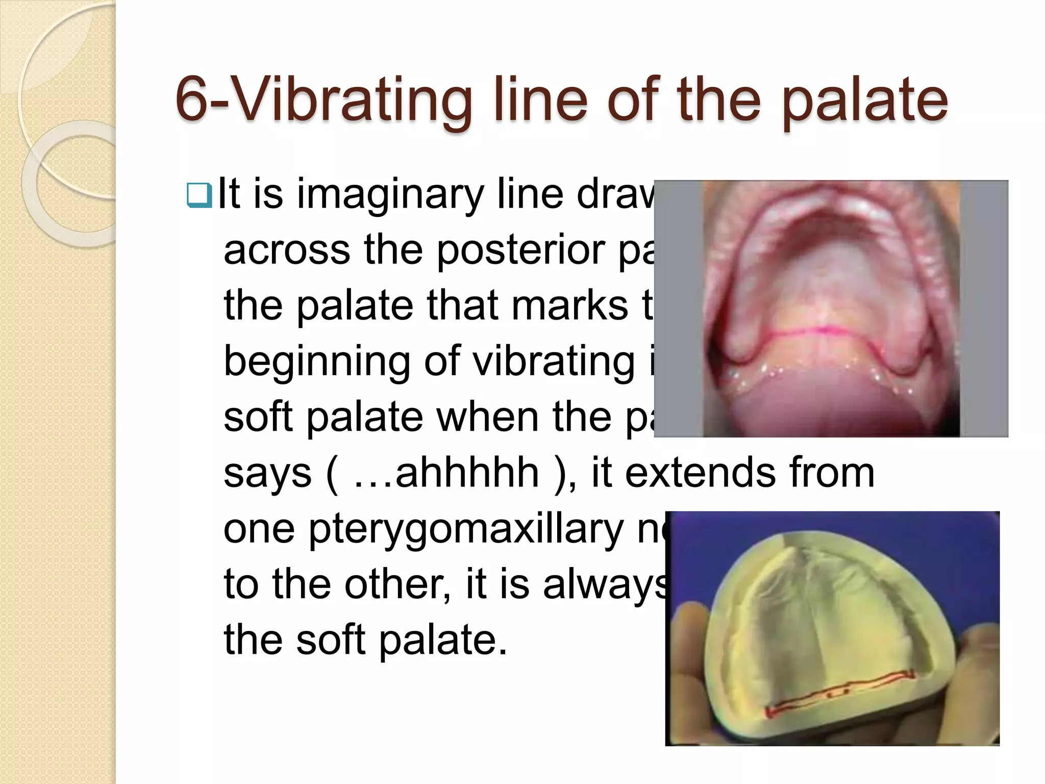 Limiting structure presentation | PPTX