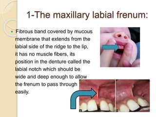Limiting structure presentation | PPTX