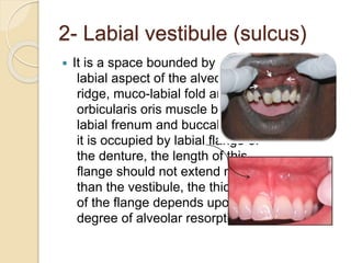 Limiting structure presentation | PPTX