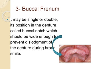 Limiting structure presentation | PPTX