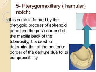 Limiting structure presentation | PPTX