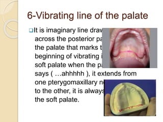 Limiting structure presentation | PPTX