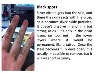 Limit test for chloride | PPTX