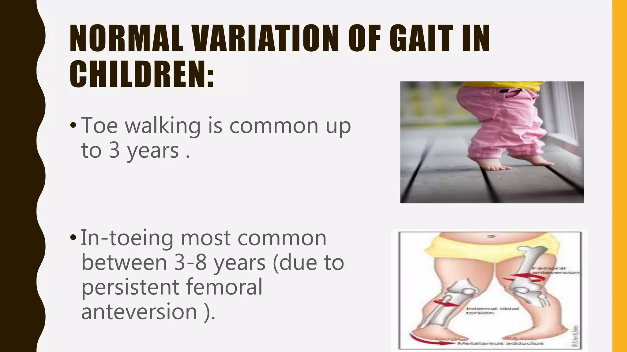 approach to Limping in pediatric | PPTX