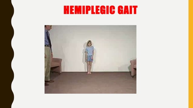 approach to Limping in pediatric | PPT