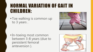 approach to Limping in pediatric | PPTX
