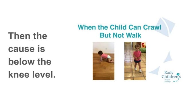 Limping in child- To rule out if cause above the knee or below the knee ...