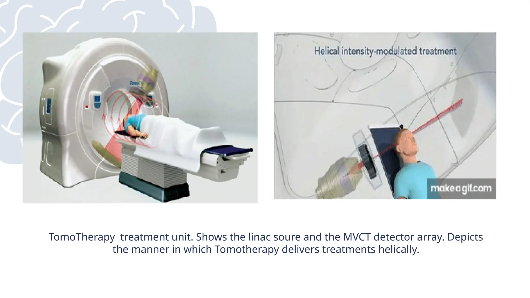 LINAC based SRS treatment - Dr Pallavi.pptx