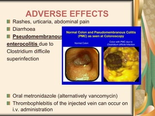LINCOSAMIDES, GLYCOPEPTIDES AND OTHER ANTIBACTERIAL DRUGS.pptx ...