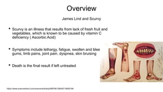 Lind and Scurvy 232.ppt