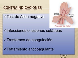 Linea arterial | PPTX