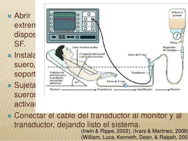 Linea arterial