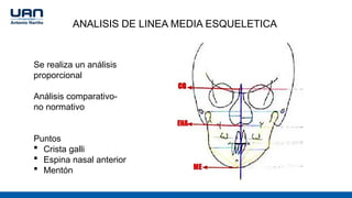 seminario linea media facial y dental.pptx