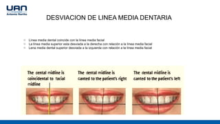 seminario linea media facial y dental.pptx