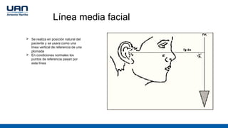 seminario linea media facial y dental.pptx
