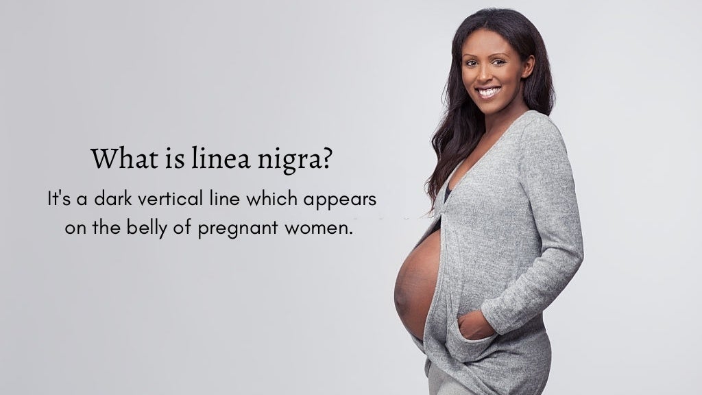 Linea Nigra Danger – Ligne Nigra Femme – SFSPF