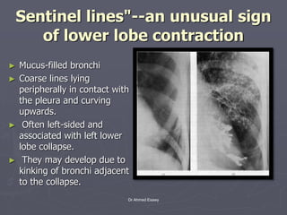 Linear lung density x ray Dr Ahmed Esawy | PDF