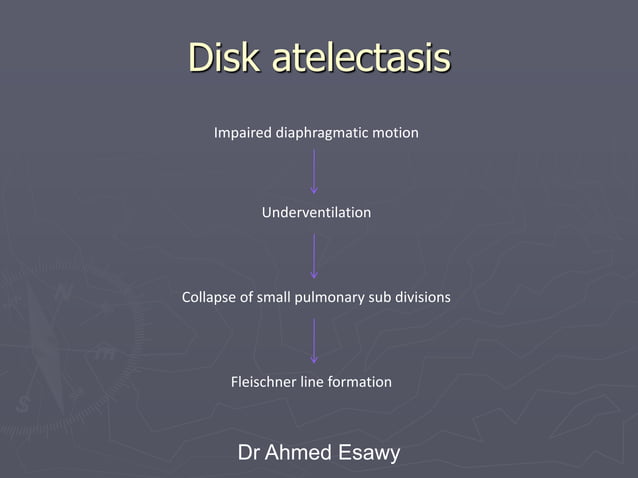 Linear lung density x ray Dr Ahmed Esawy | PDF
