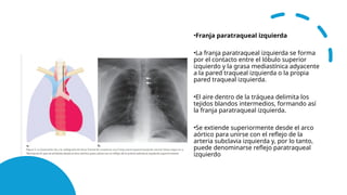 lineas y rayas en la radiografia de torax | PPTX