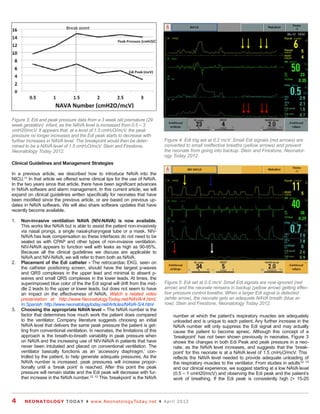 Linee guida nava nel neonato | PDF