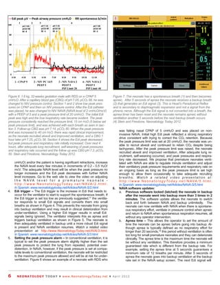 Linee guida nava nel neonato | PDF